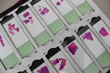 Anatomic Pathology - University of Mississippi Medical Center