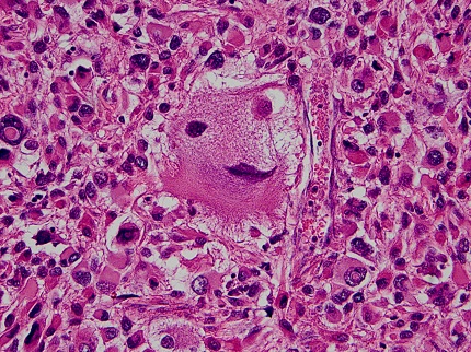 Pathology Educational Programs - University of Mississippi Medical Center