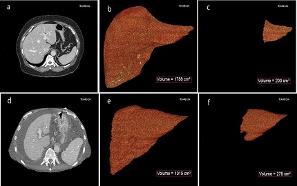 Radiology Research - University of Mississippi Medical Center